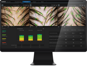 The Future of Hair Care: An Insight into the AI-Based Hair Metrix ...